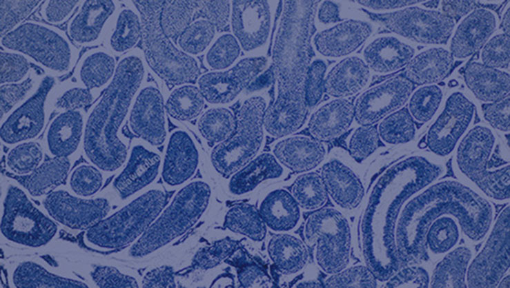 Freeze Dryers & Lyophilizers | Millrock Technology, Inc